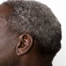 Smelly Ear Wax Causes & Treatment | Why Does My Ear Smell