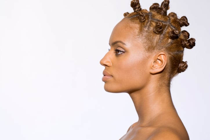 Black Women & CCC Alopecia: 5 Things You Must Know | BlackDoctor.org ...