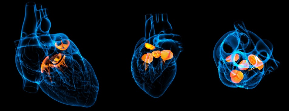 Heart Valve Disease: What We Don’t Know is Killing Us - BlackDoctor.org ...