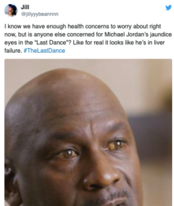 After Seeing Michael Jordan's Eyes, Some Fans Are Concerned About His ...