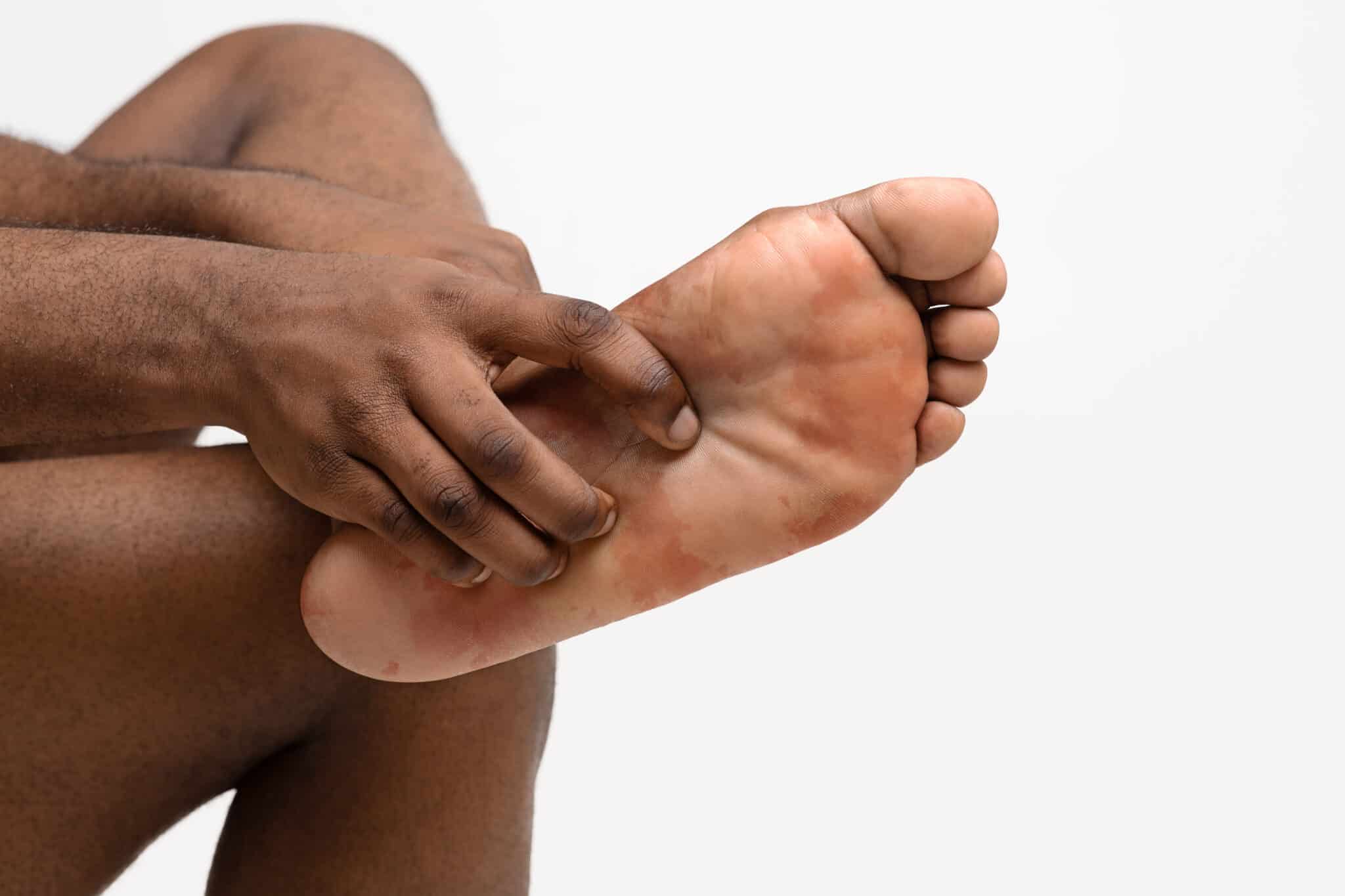 7 Serious Reasons Your Feet & Ankles are Swollen - BlackDoctor.org