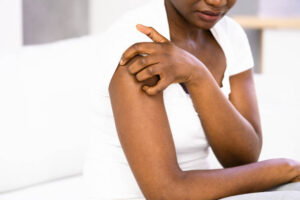 Living with HIV: How To Treat HIV Rashes - BlackDoctor.org