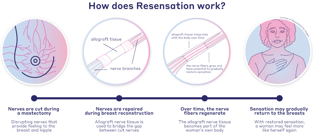 Restoring Sensation During Breast Reconstruction - BlackDoctor.org