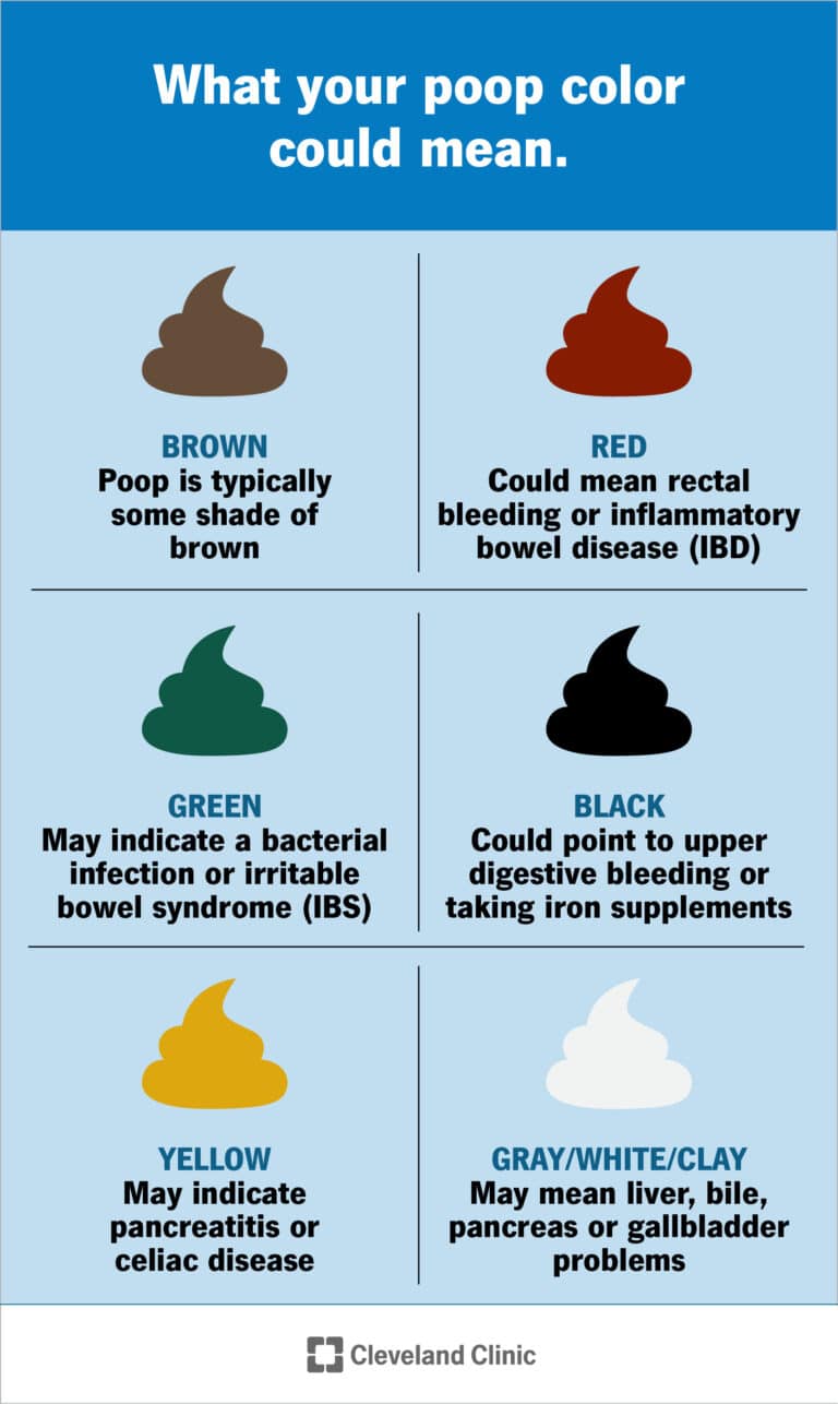 Poop Color Chart: What Does the Color of Your Poop Mean