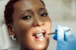 Tongue and Mouth Signs of HIV - BlackDoctor.org - Where Wellness ...